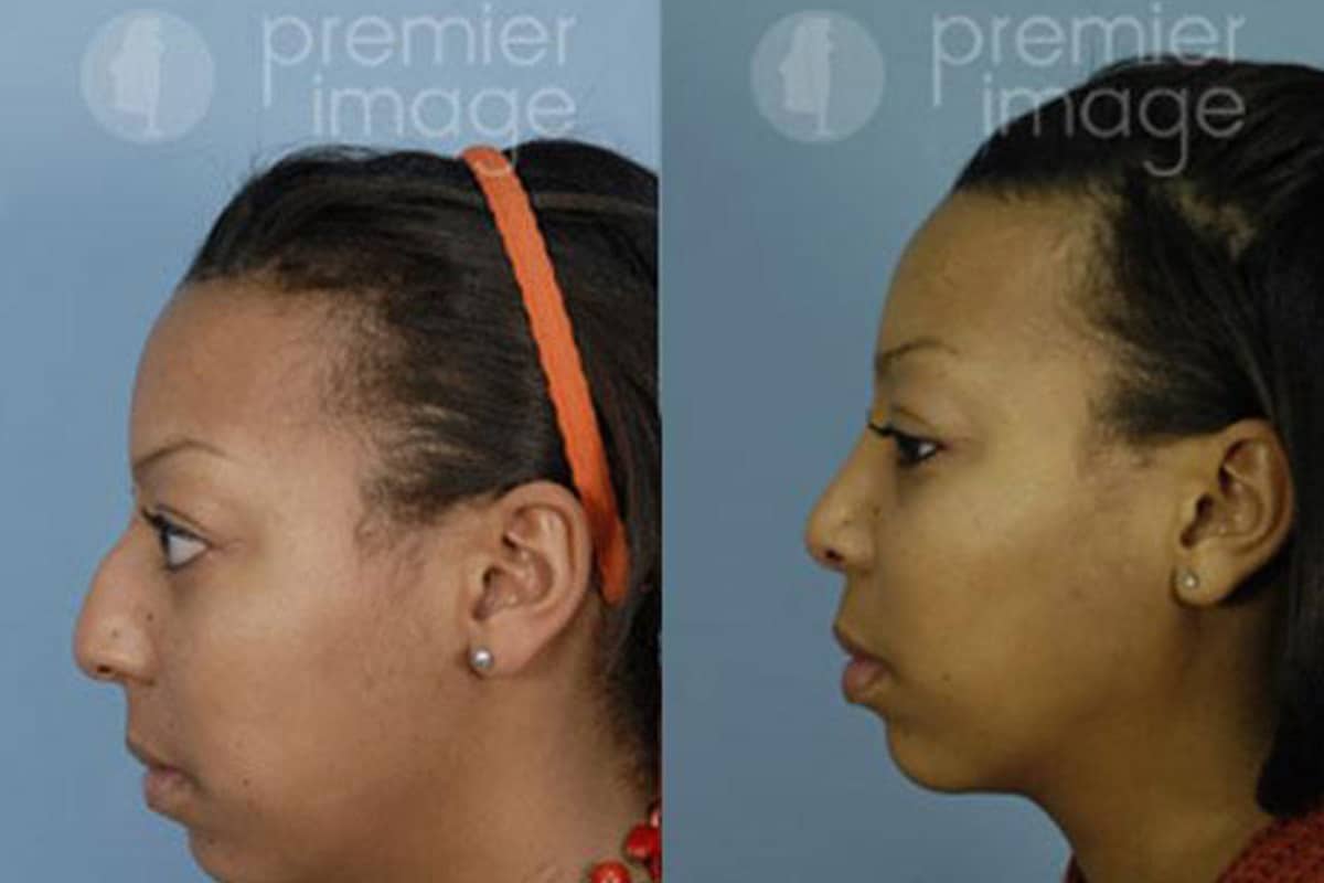 Ethnic Cosmetic Surgery can enhance your appearance
