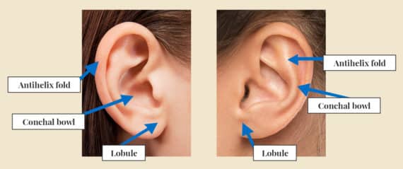 Otoplasty Atlanta, GA | Sandy Springs | Dr. Louis DeJoseph